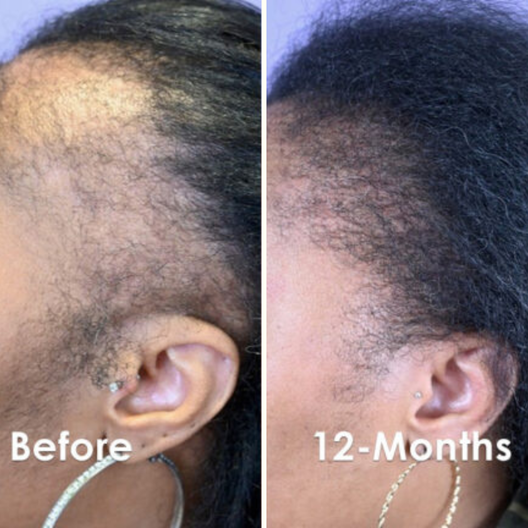 Endoten Hair / Regenerate your scalp's health