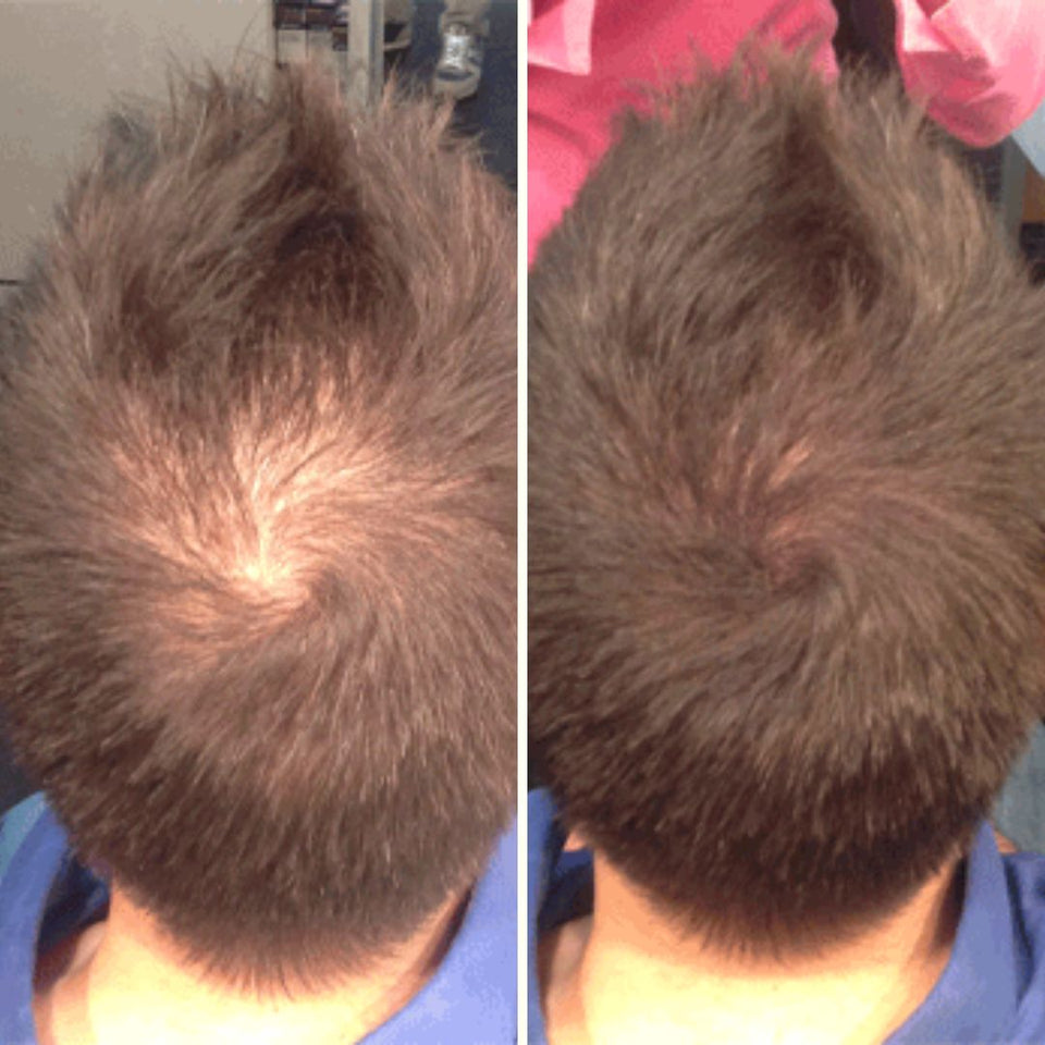 Endoten Control Lotion 200 ml - Hair & scalp treatment with Ginseng