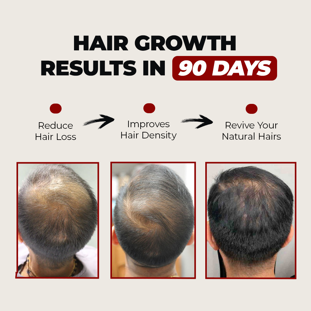 Endoten Control Lotion 200 ml - Hair & scalp treatment with Ginseng